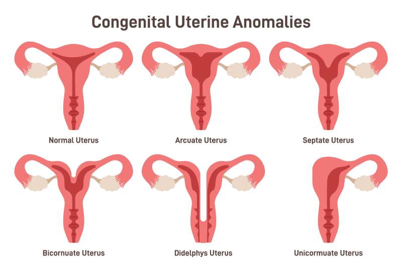 Understanding Heart-Shaped Uterus : Symptoms, Causes, Fertility